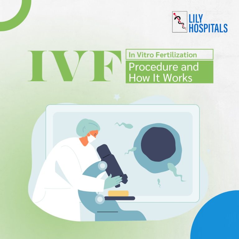IVF (In Vitro Fertilization): Procedure & How It Works