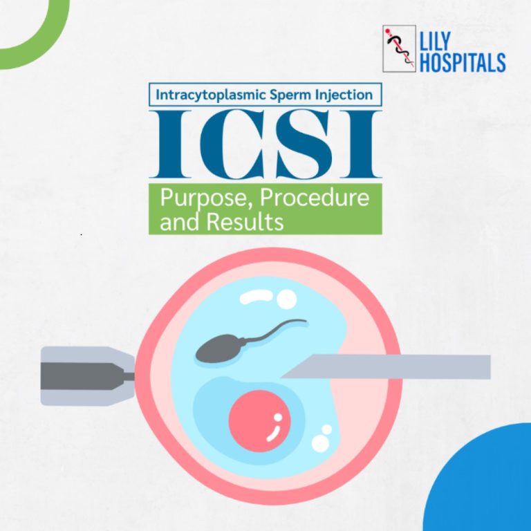 ICSI - Intracytoplasmic Sperm Injection All You Need To Know